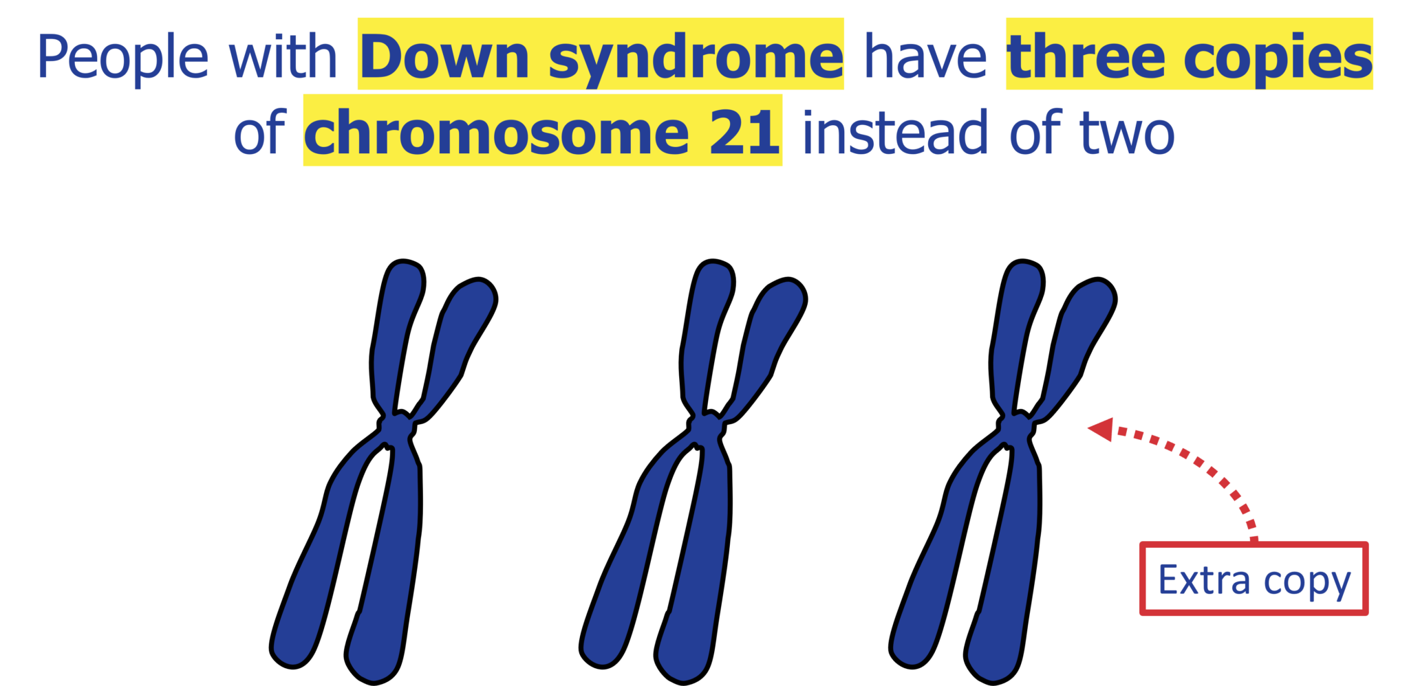 ABATE study | Alzheimer’s Disease and Down Syndrome